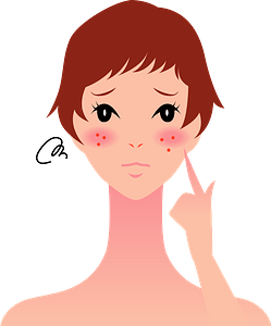 Woman with Skin Rash - Free vector clipart images on creazilla.com