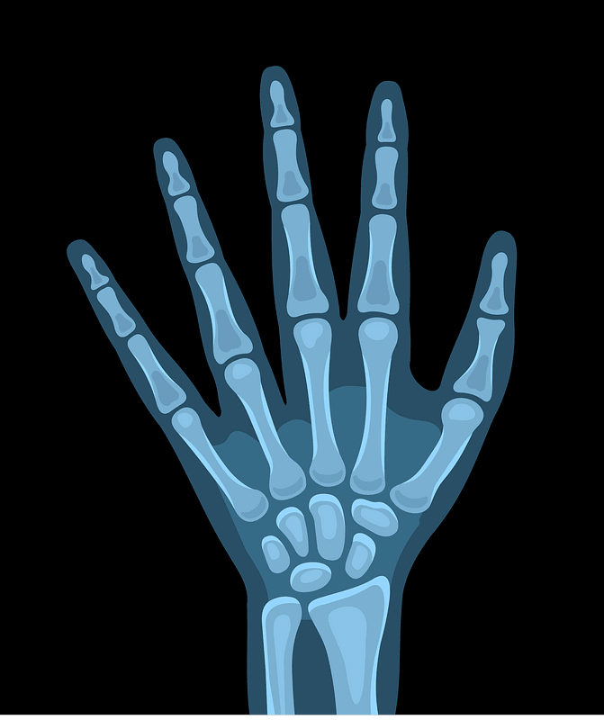 X Ray clipart. Free download transparent .PNG | Creazilla