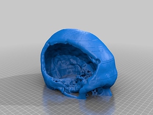 craniotomy - Free 3d model on creazilla.com